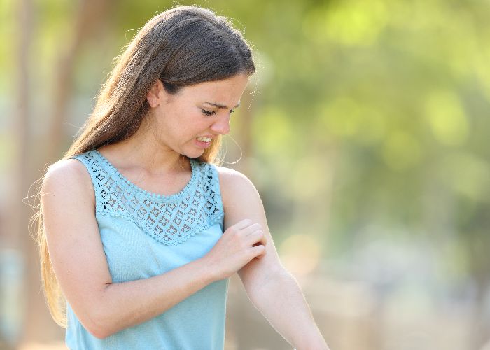 6 solutions pour se débarrasser des démangeaisons dues au rhume des foins